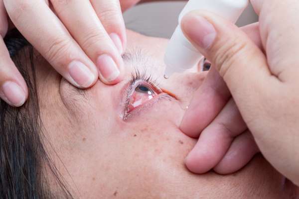 Keratitis – symptoms, prevention, and treatment - ReliableRxPharmacy ...