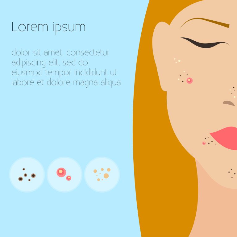 Should You Pop That Boil? - ReliableRxPharmacy Blog, Health Blog