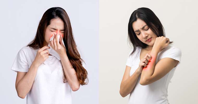 Understanding Allergy Types, Symptoms and Treatment