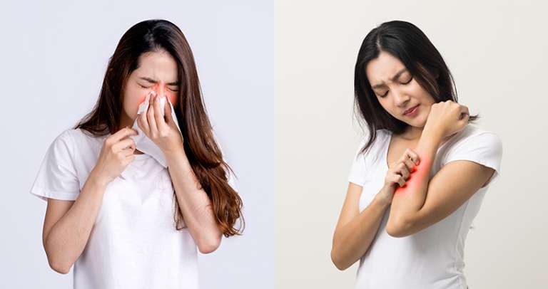 Understanding Allergy Types, Symptoms and Treatment